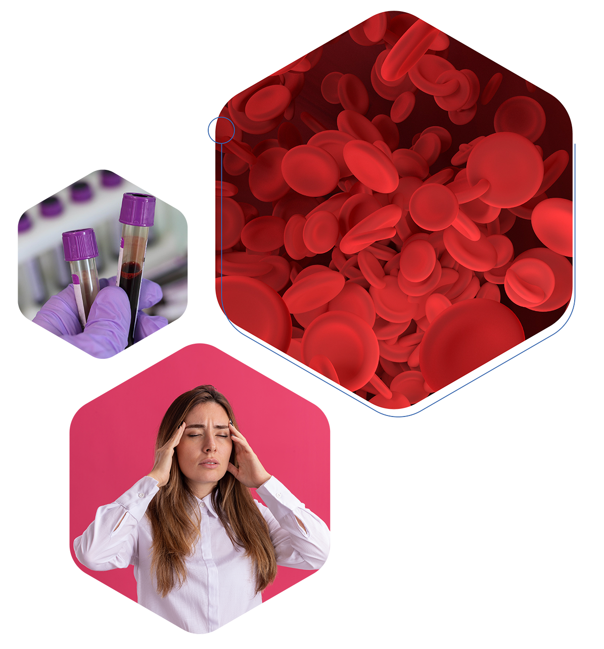 Bloedonderzoek - NL-Lab